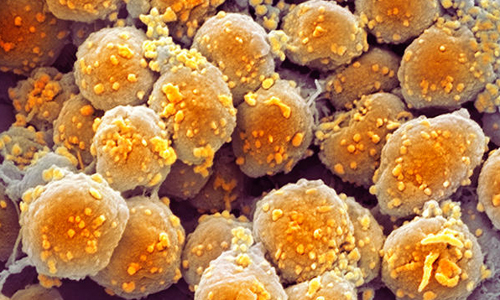 Archaea and the Tree of Life