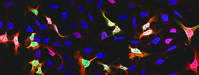 Young Microbiologist of the Year 2021 Competition: Meet the finalists ...