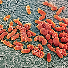 Save the date: Protein Secretion at the Host-Pathogen Interface ...