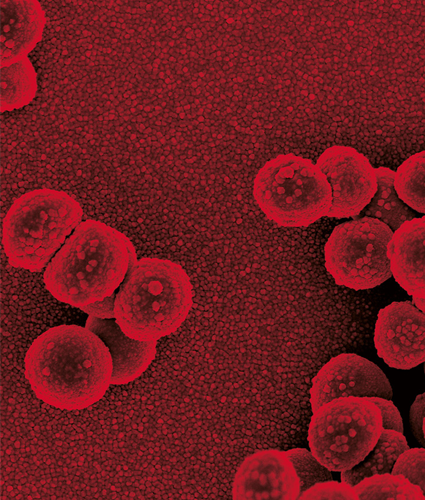 JMM Editor’s Choice: an uncommon but significant bacterial pathogen in ...