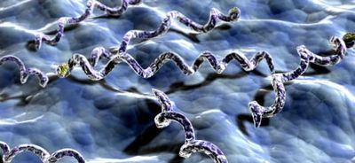 Syphilis - the great scourge | Microbiology Society