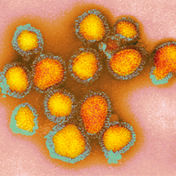 A special sugar: how sialic acid impacts on metabolism, health and ...