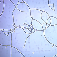 Mycoprotein production and food sustainability | Microbiology Society