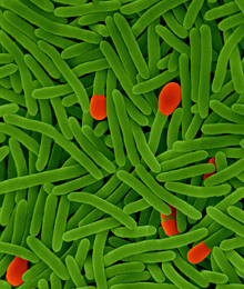 Prostate cancer biopsies show evidence of Cutibacterium acnes infection ...