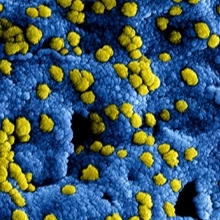 MERS - The facts | Microbiology Society